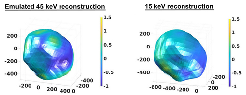 The Aps Upgrade Will Enable Improved Bragg Coherent Diffraction Imaging